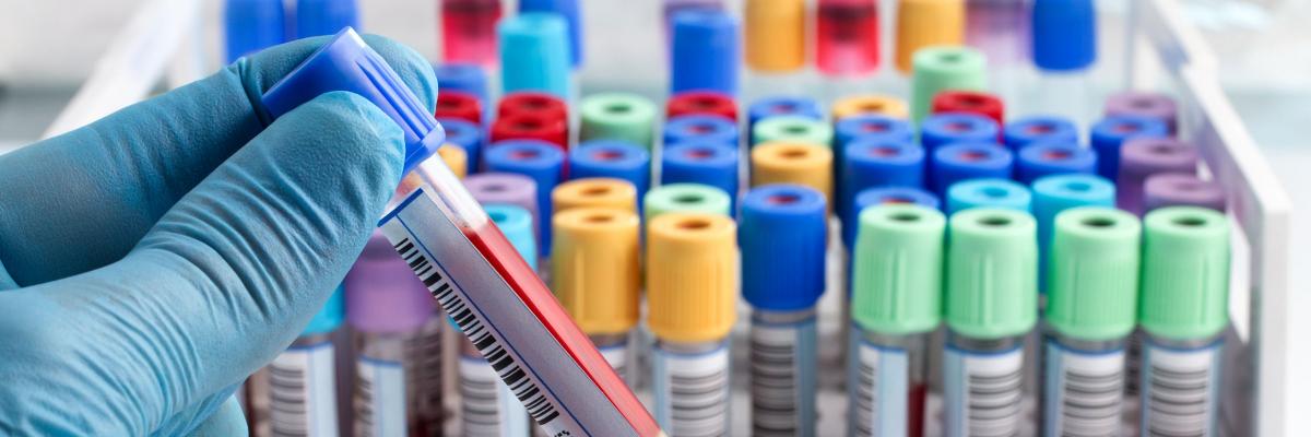 Beebe Healthcare Laboratory Services